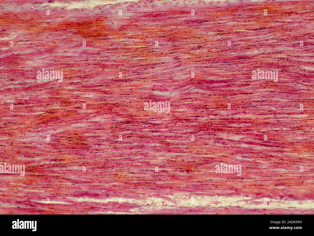 Tendon. Light micrograph of a longitudinal section through normal human ...
