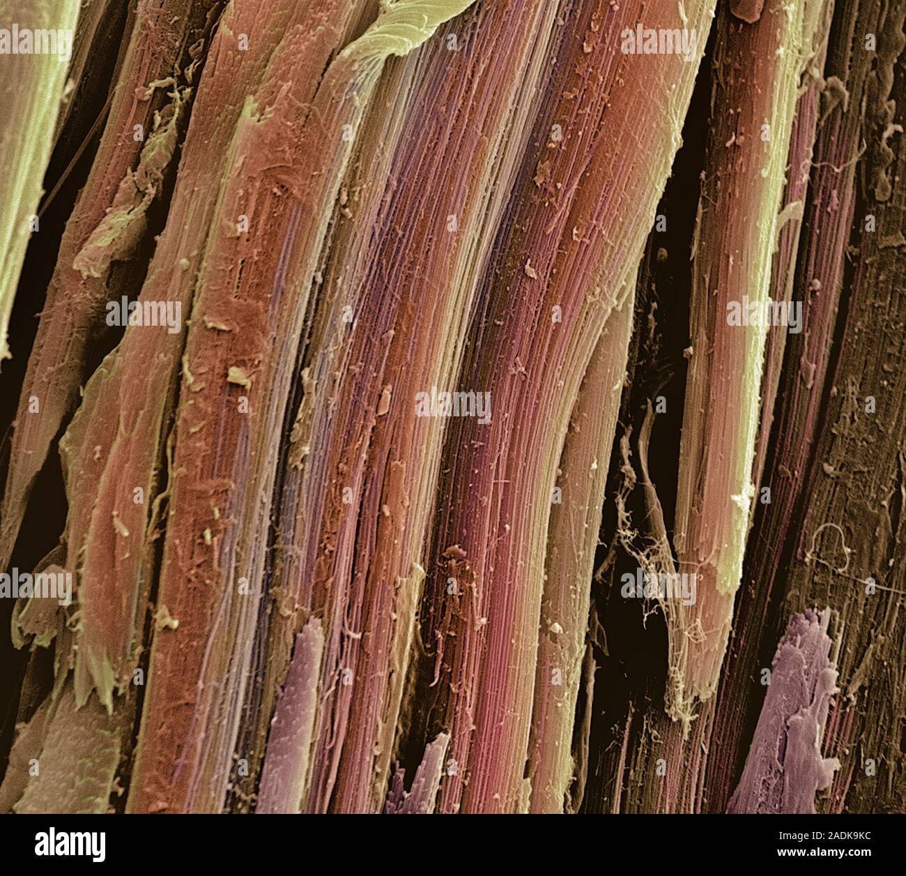 Tendon. Coloured scanning electron micrograph (SEM) of a freeze ... Tendon. Coloured scanning electron micrograph (SEM) of a freeze ...