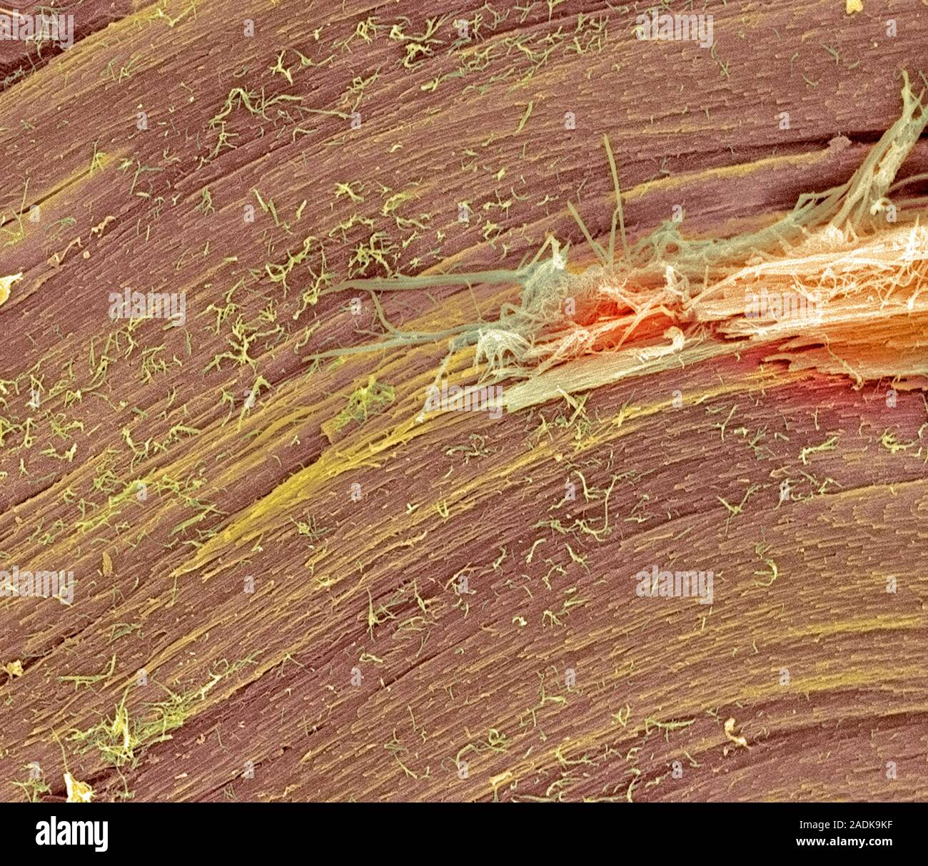 Tendon. Coloured scanning electron micrograph (SEM) of a freeze ...