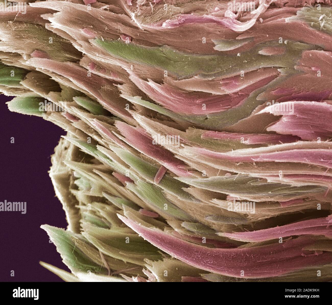 Tendon. Coloured scanning electron micrograph (SEM) of a freeze ...