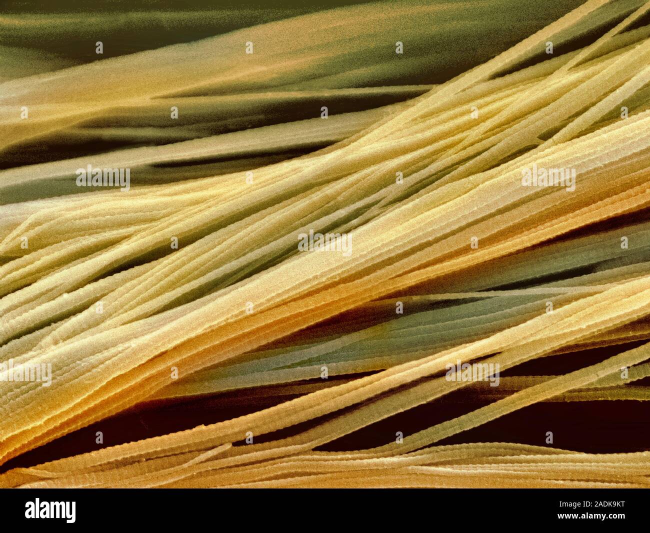 Tendon fibres. Coloured scanning electron micrograph (SEM) of tendon ...
