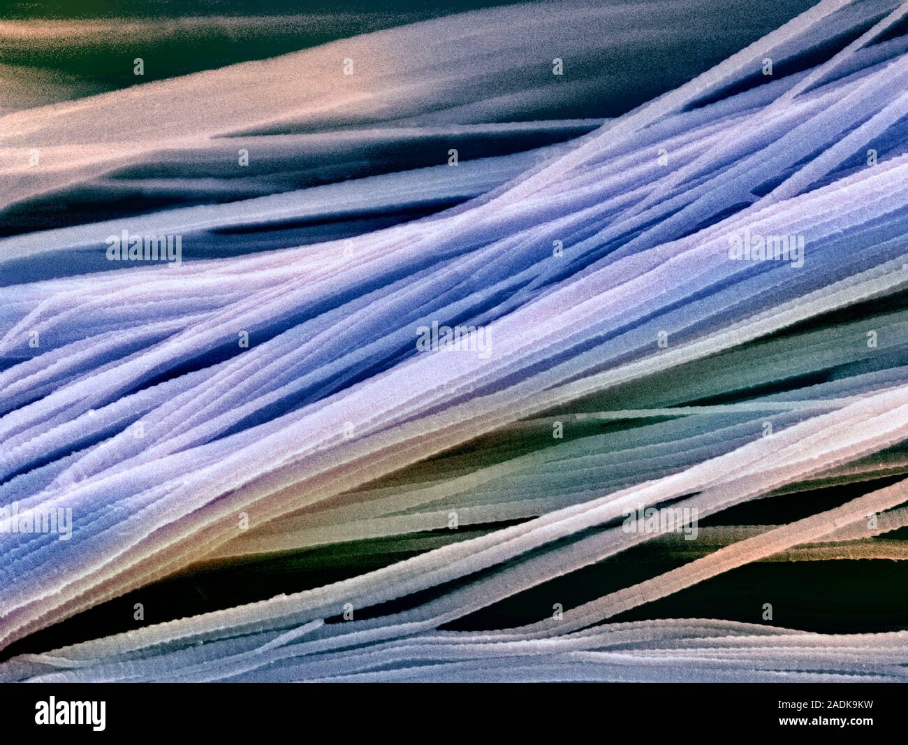 Tendon fibres. Coloured scanning electron micrograph (SEM) of tendon ...