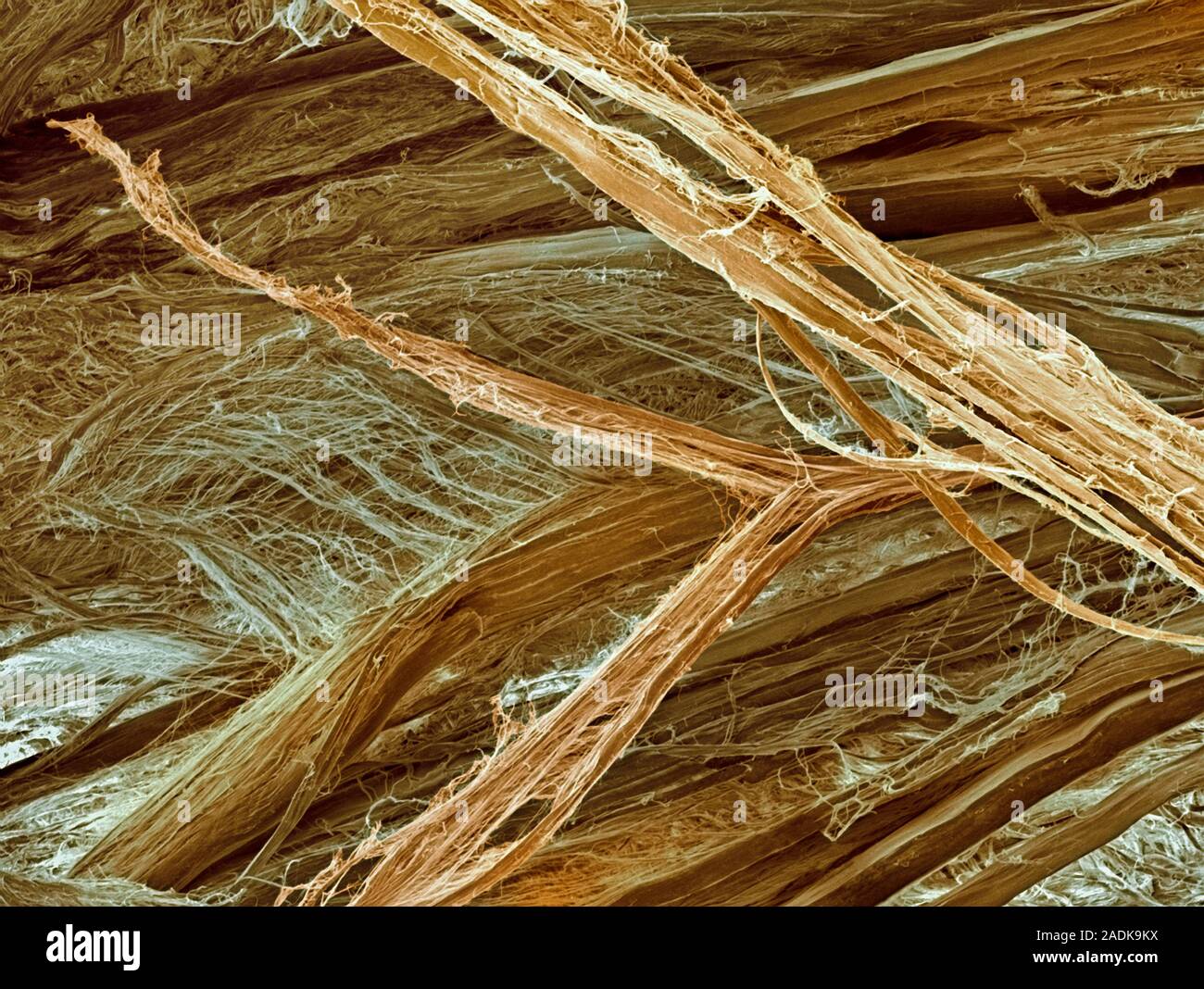 Tendon fibres. Coloured scanning electron micrograph (SEM) of tendon ... Tendon fibres. Coloured scanning electron micrograph (SEM) of tendon ...