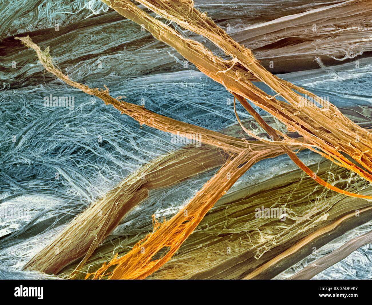Tendon fibres. Coloured scanning electron micrograph (SEM) of tendon ...