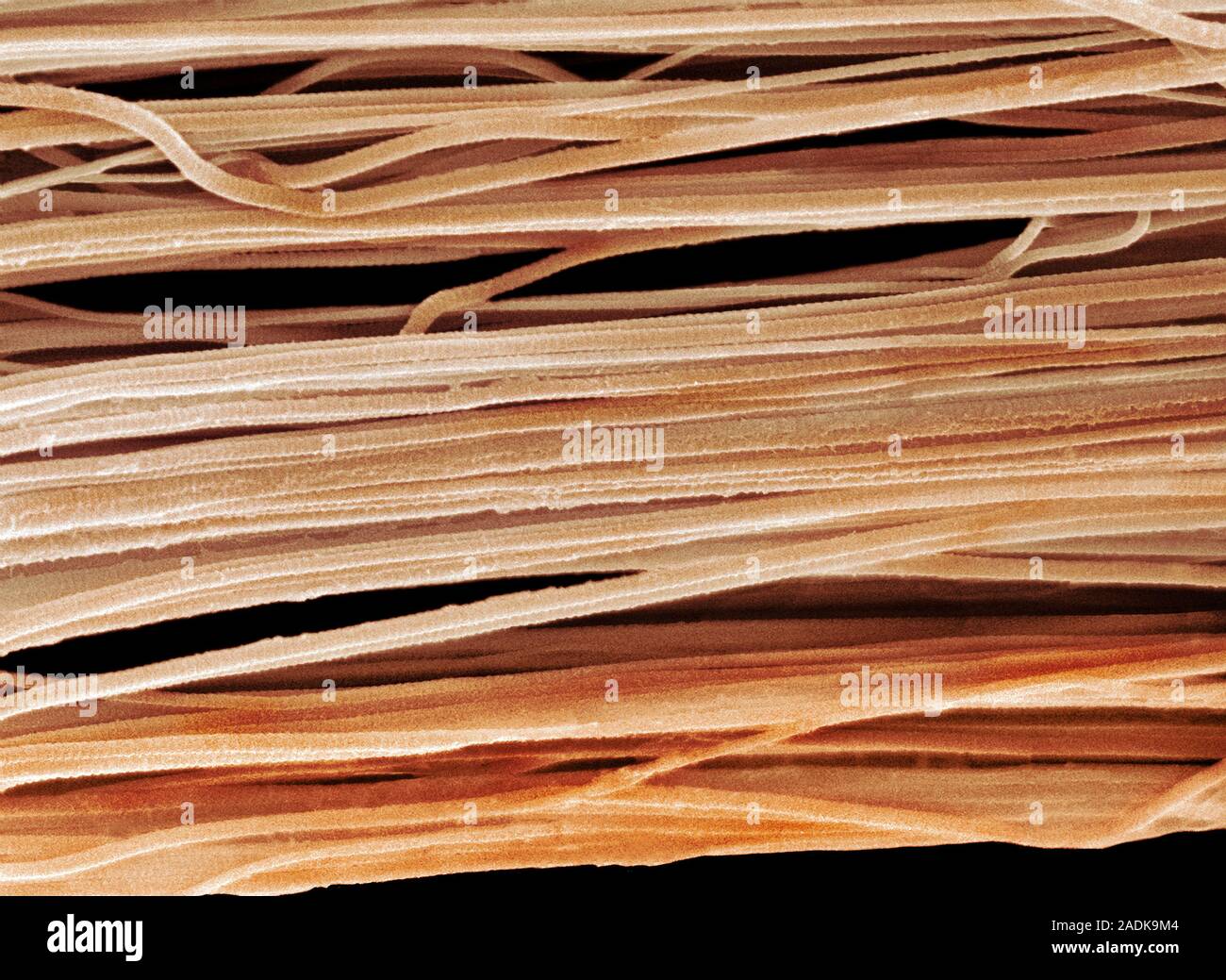 Tendon fibres. Coloured scanning electron micrograph (SEM) of tendon ... Tendon fibres. Coloured scanning electron micrograph (SEM) of tendon ...