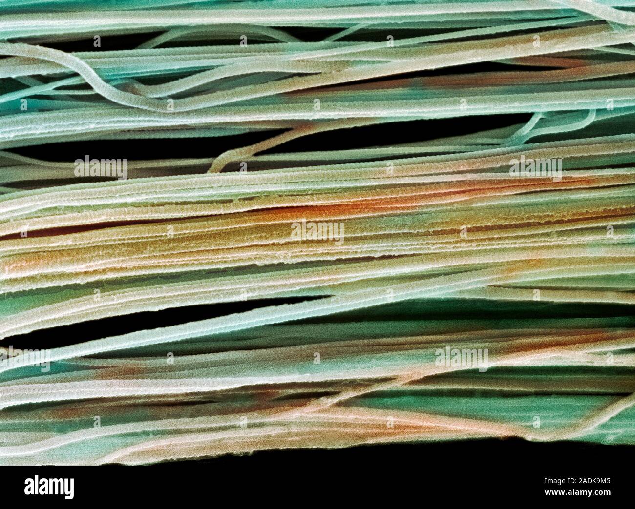 Tendon fibres. Coloured scanning electron micrograph (SEM) of tendon ... Tendon fibres. Coloured scanning electron micrograph (SEM) of tendon ...