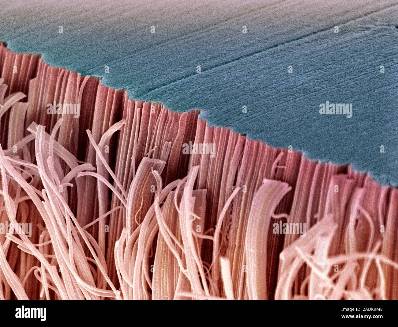 Tendon. Coloured scanning electron micrograph (SEM) of a section ... Tendon. Coloured scanning electron micrograph (SEM) of a section ...