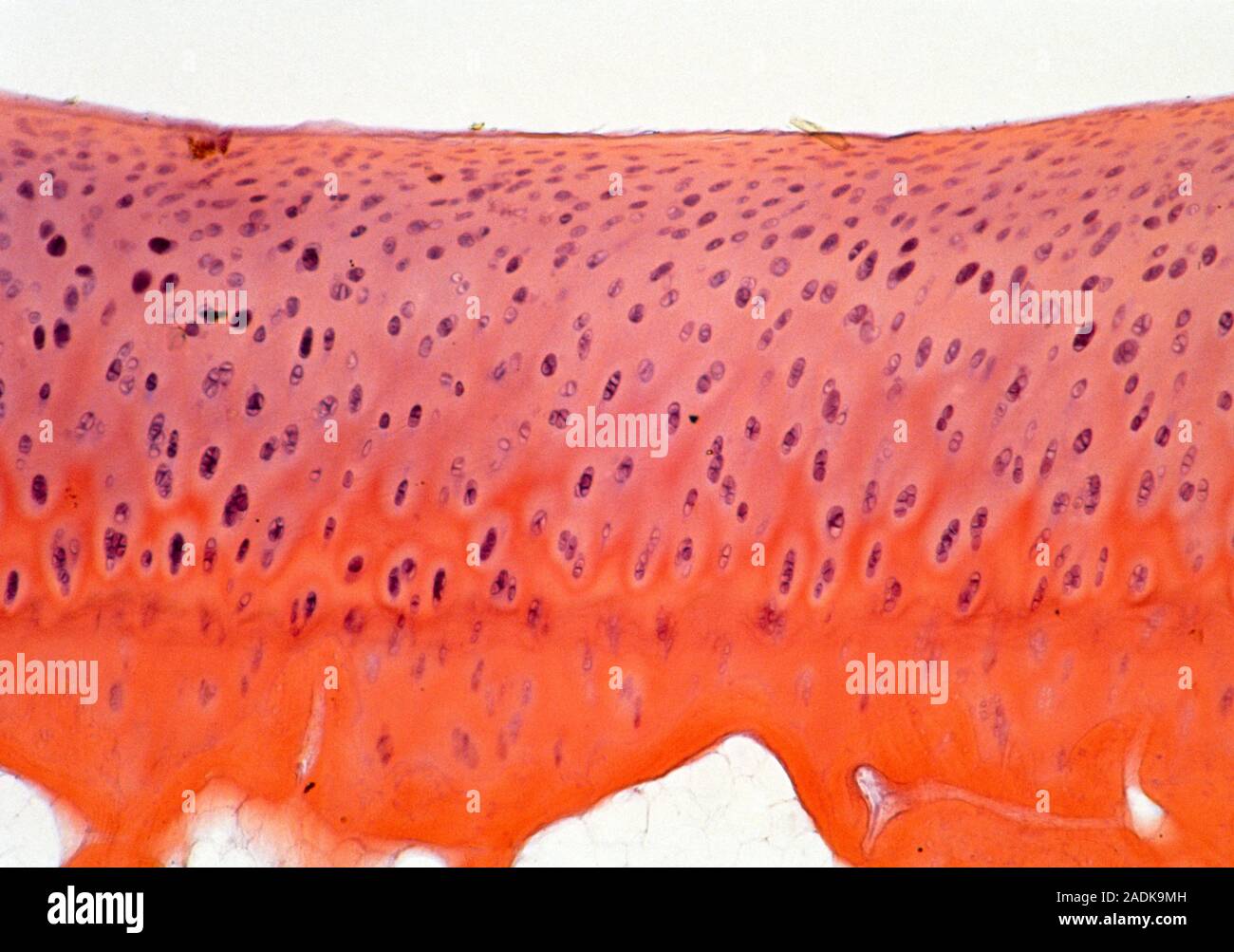 Light micrograph of normal human cartilage at the surface of an ...
