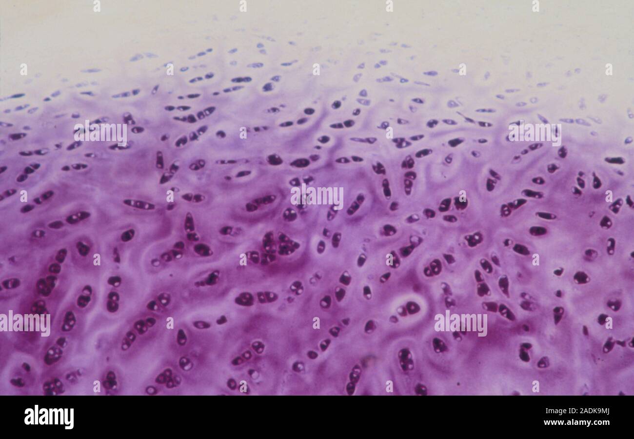 Light micrograph of cartilage from normal human rib (costal cartilage ...