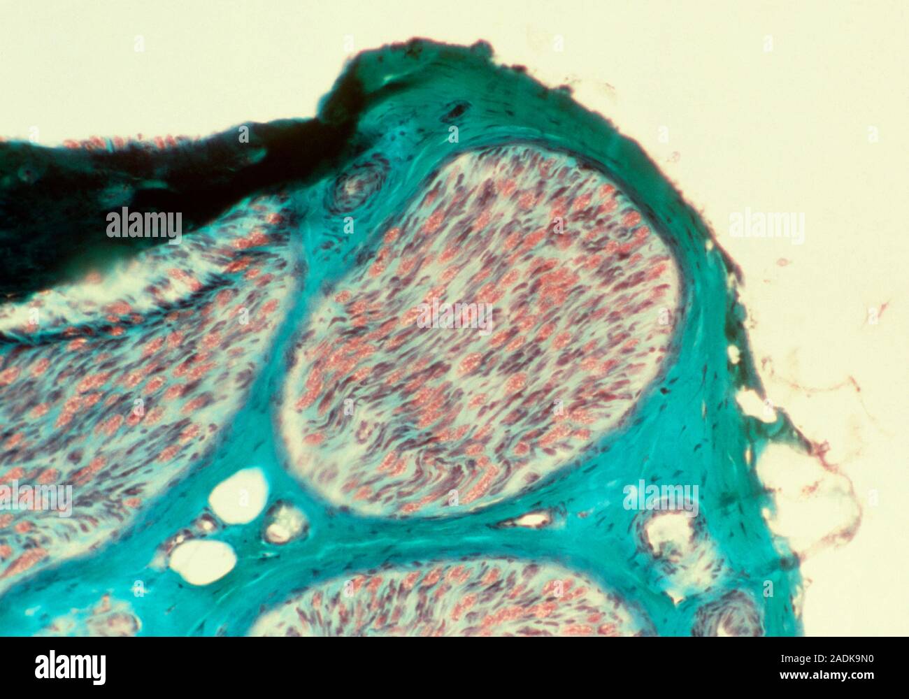 Developing cartilage. Light micrograph of a section through developing ...