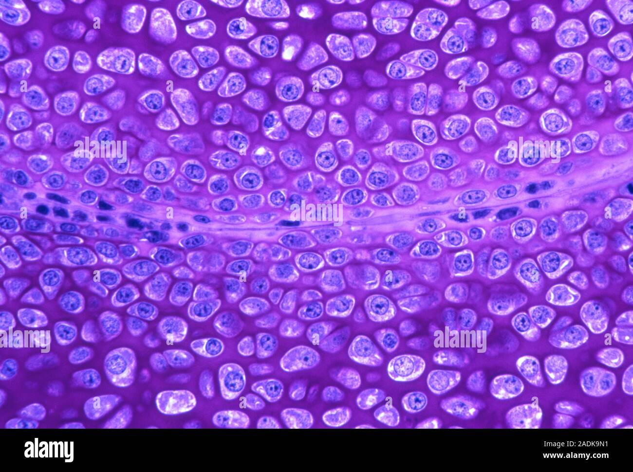 Cartilage Connective Tissue Connective Tissues — See Why Anatomy