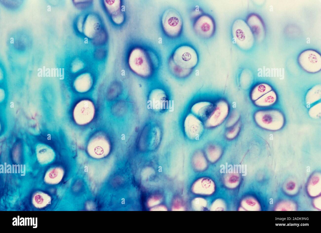 Hyaline Cartilage Connective Tissue