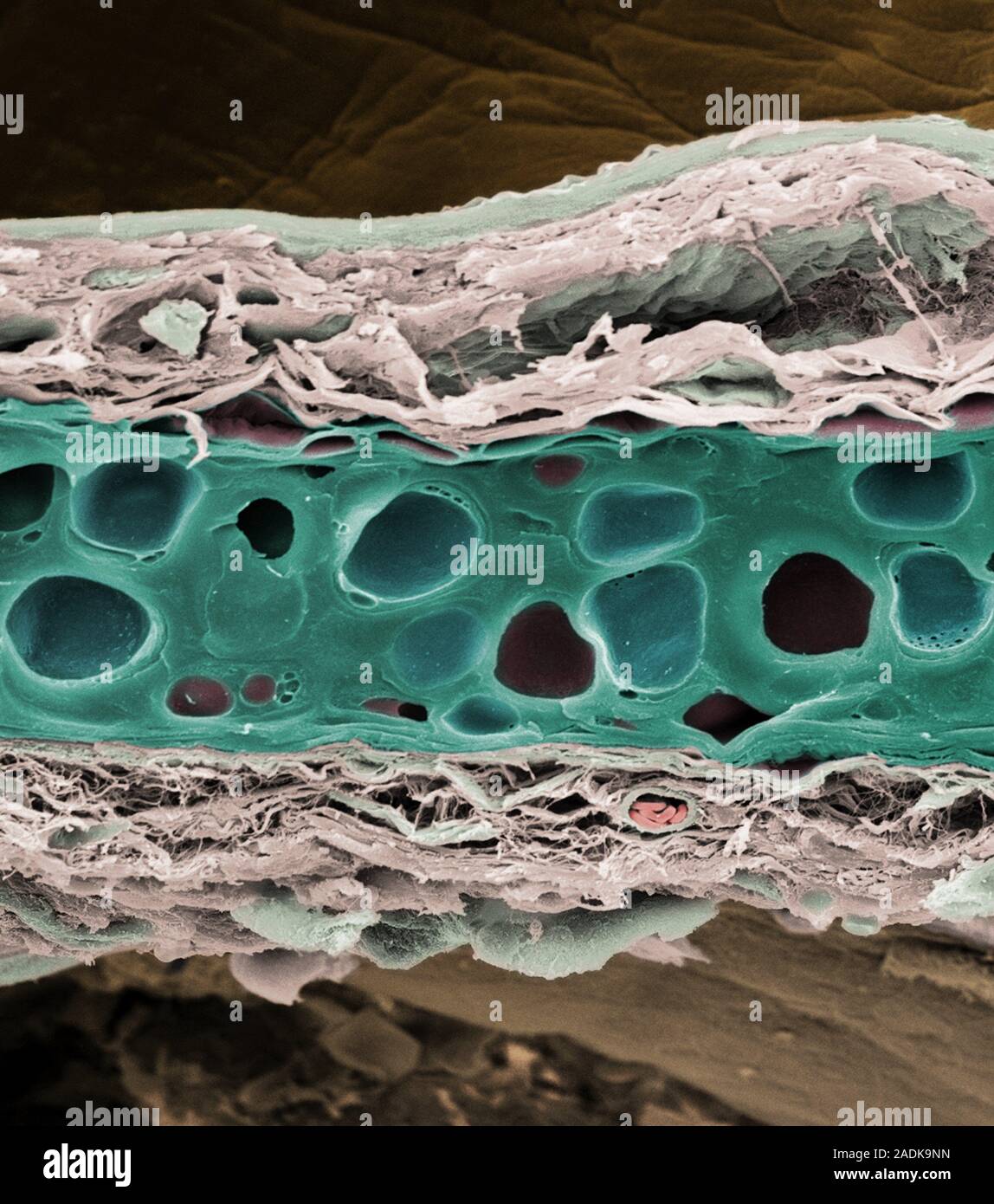 Elastic cartilage. Coloured scanning electron micrograph (SEM) of a section through elastic ...