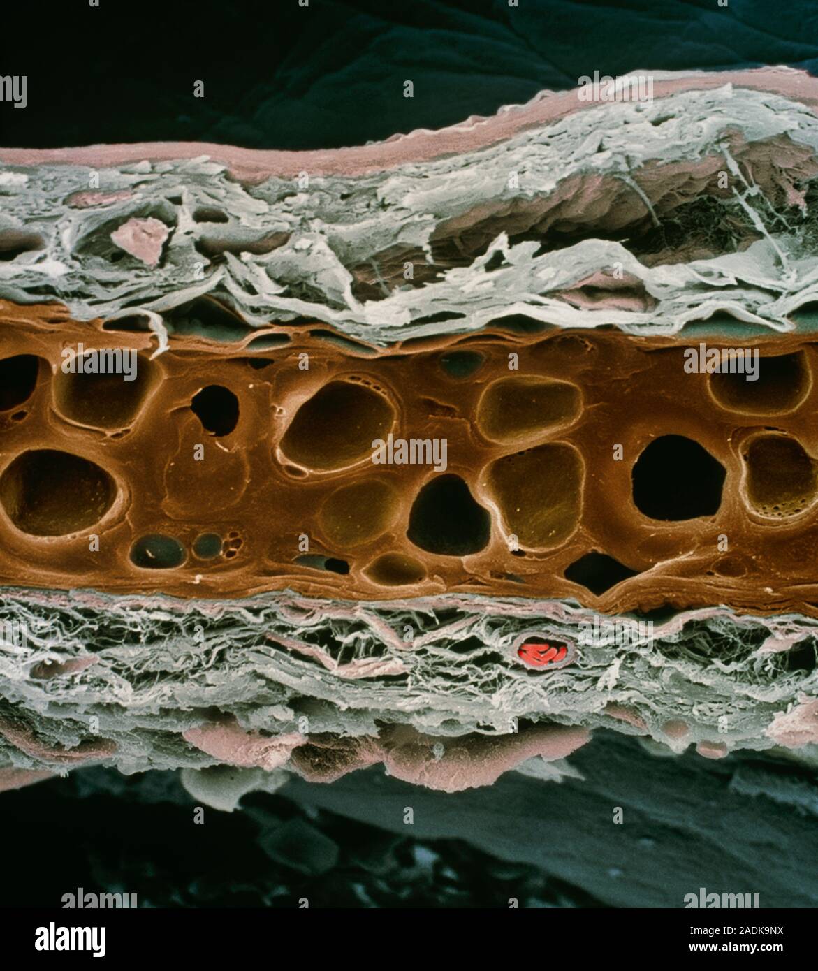 Elastic cartilage. Coloured scanning electron micrograph (SEM) of a ...