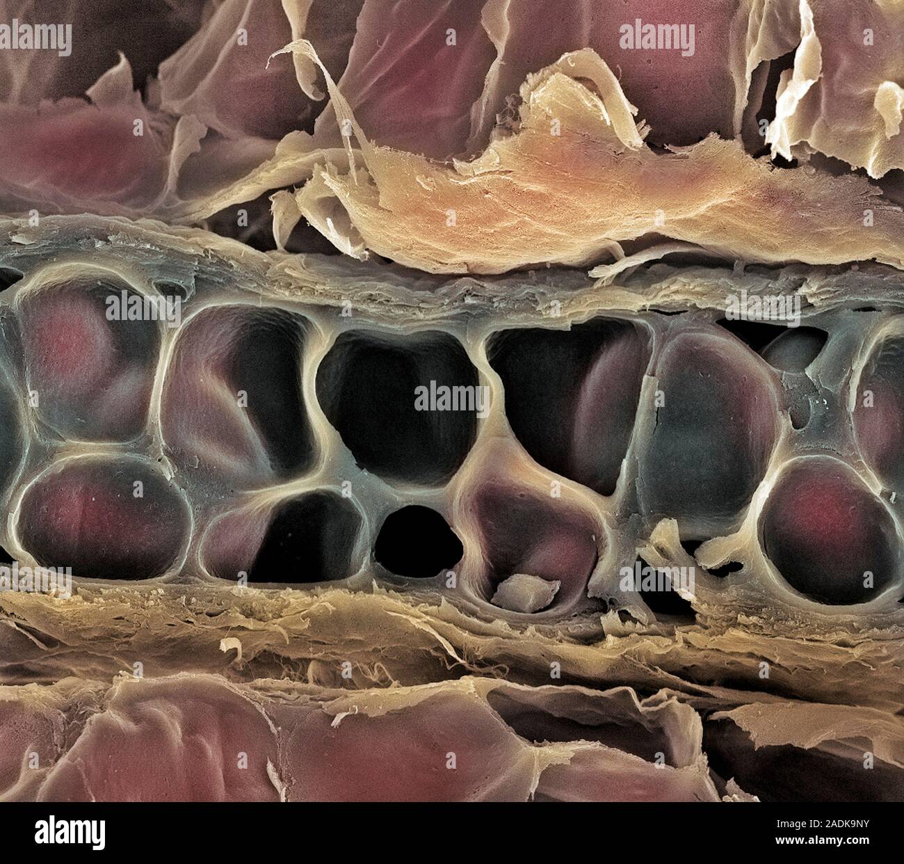 Elastic cartilage. Coloured scanning electron micrograph (SEM) of a ...