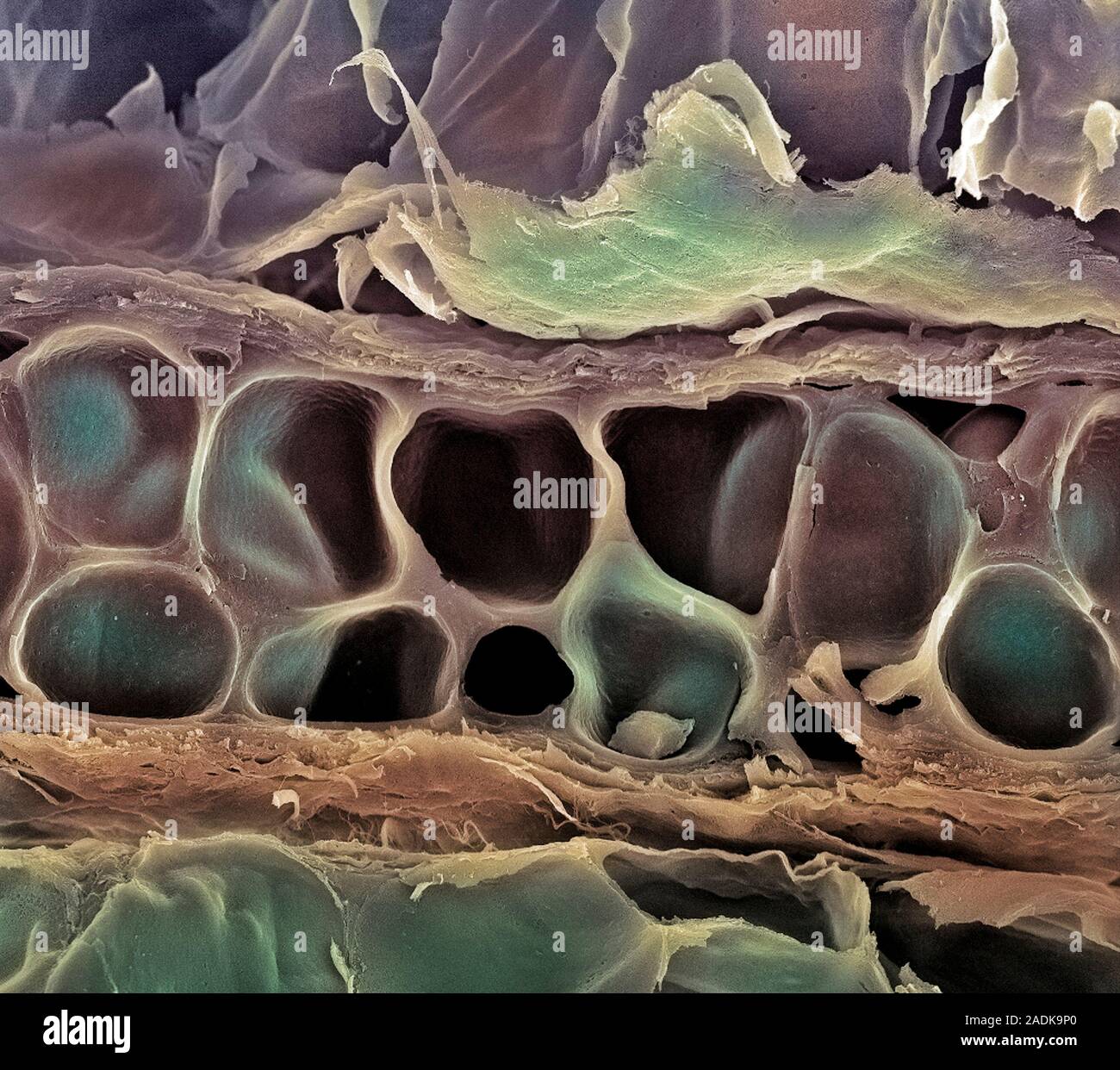 Elastic cartilage. Coloured scanning electron micrograph (SEM) of a section through elastic ...