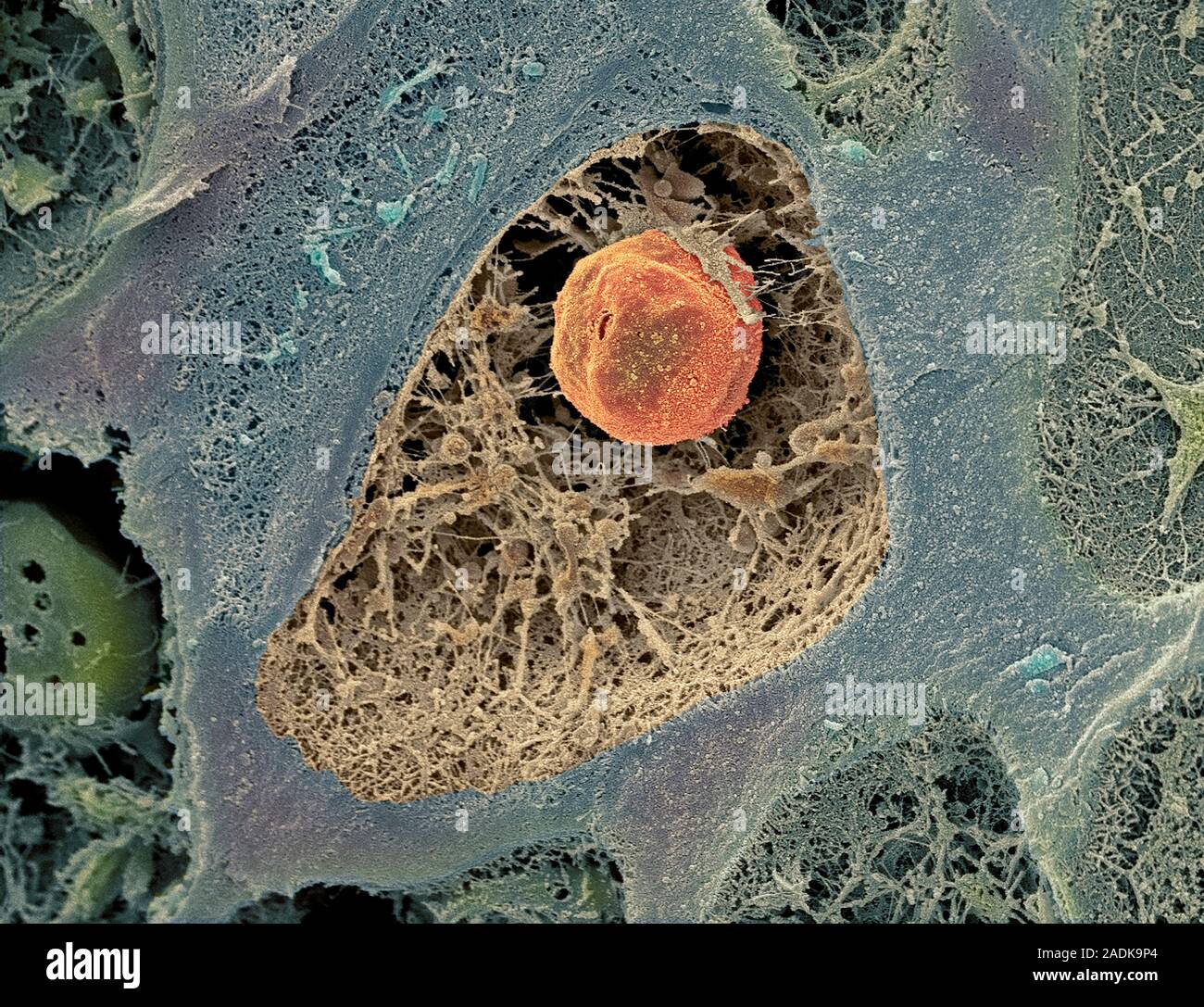 Cartilage cell. Coloured scanning electron micrograph (SEM) of a ...