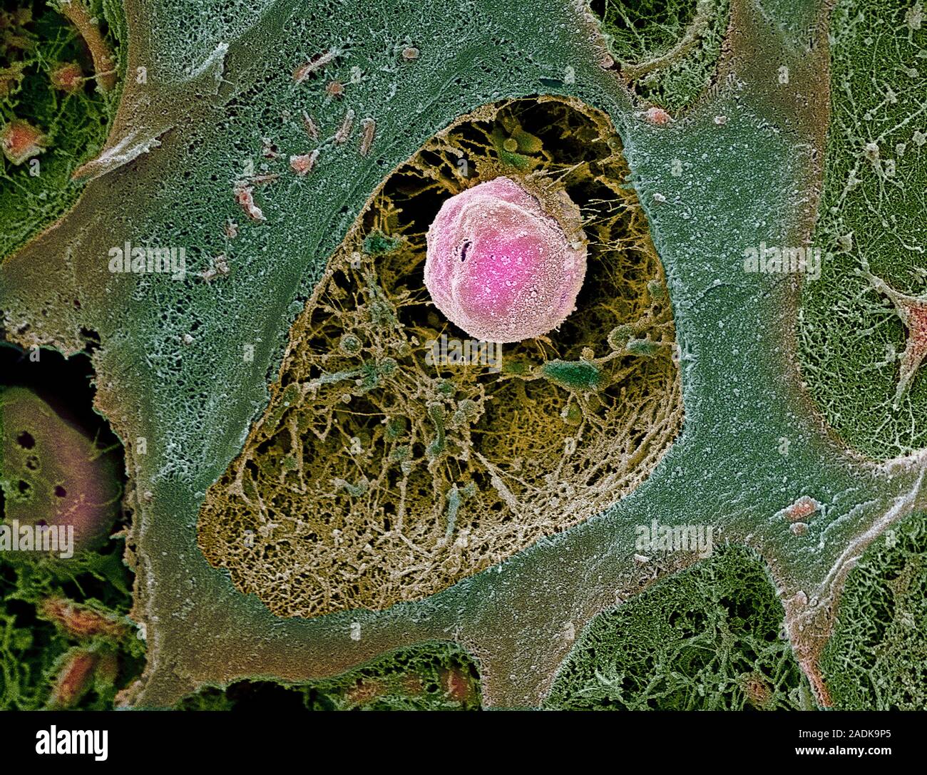 Cartilage cell. Coloured scanning electron micrograph (SEM) of a section through a chondrocyte ...