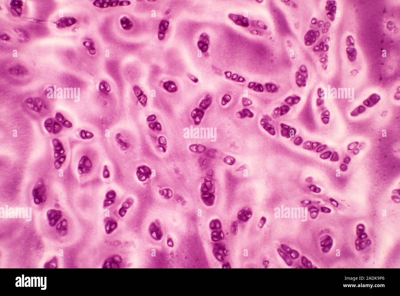 Hyaline cartilage. Light micrograph (LM) of cartilage from a human rib ...