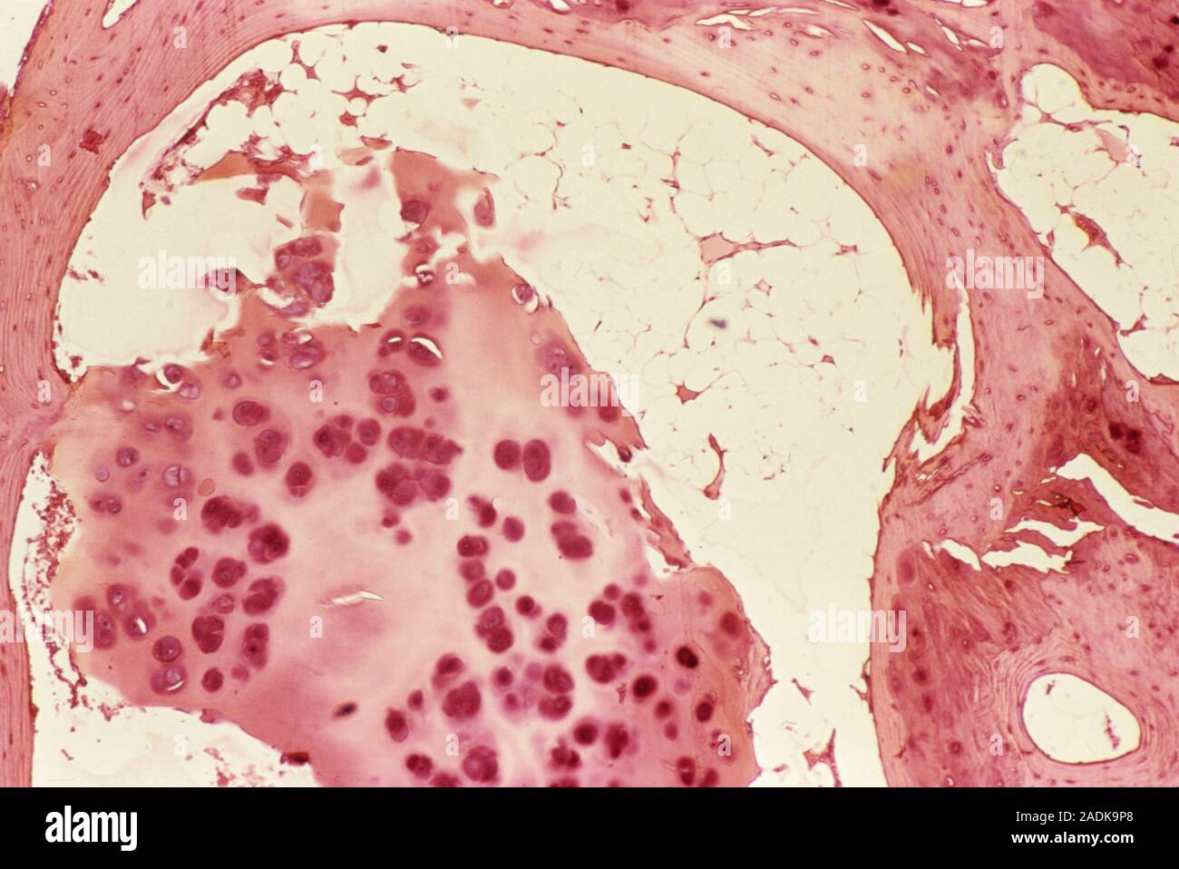 Cartilage. Light micrograph of metaplastic cartilage of the larynx. The ...