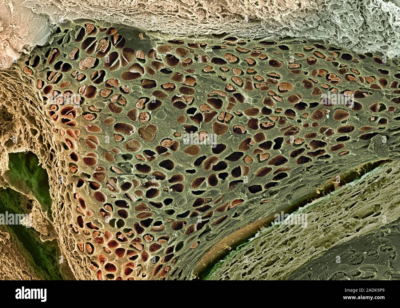 Hyaline cartilage. Coloured scanning electron micrograph (SEM) of hyaline cartilage from the ...