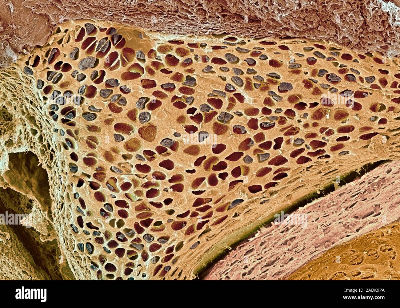 Hyaline cartilage. Coloured scanning electron micrograph (SEM) of hyaline cartilage from the ...