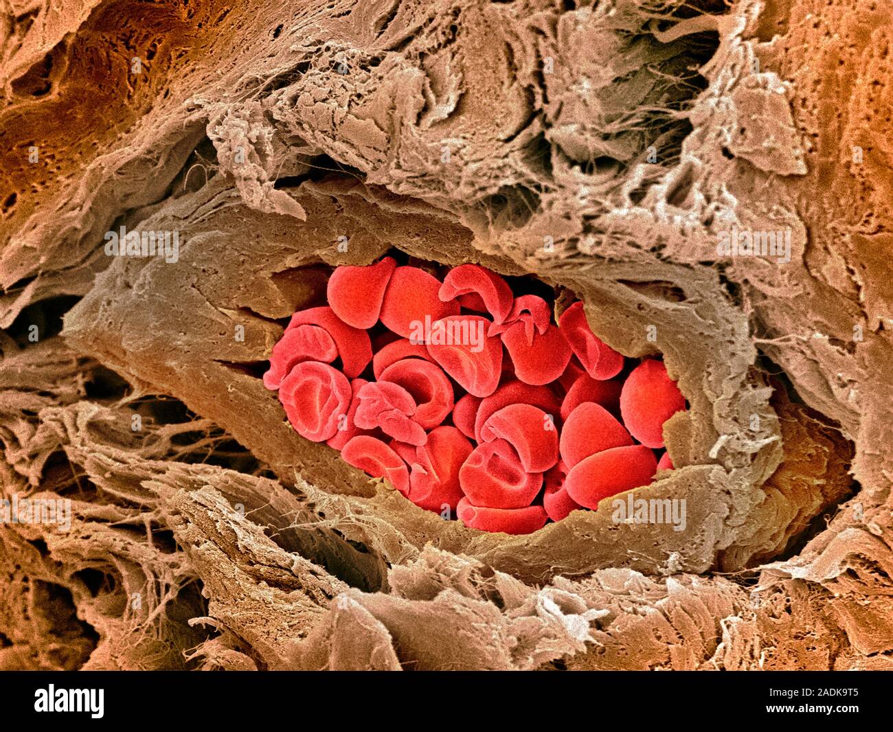 Coronary artery. Coloured scanning electron micrograph (SEM) of an ...
