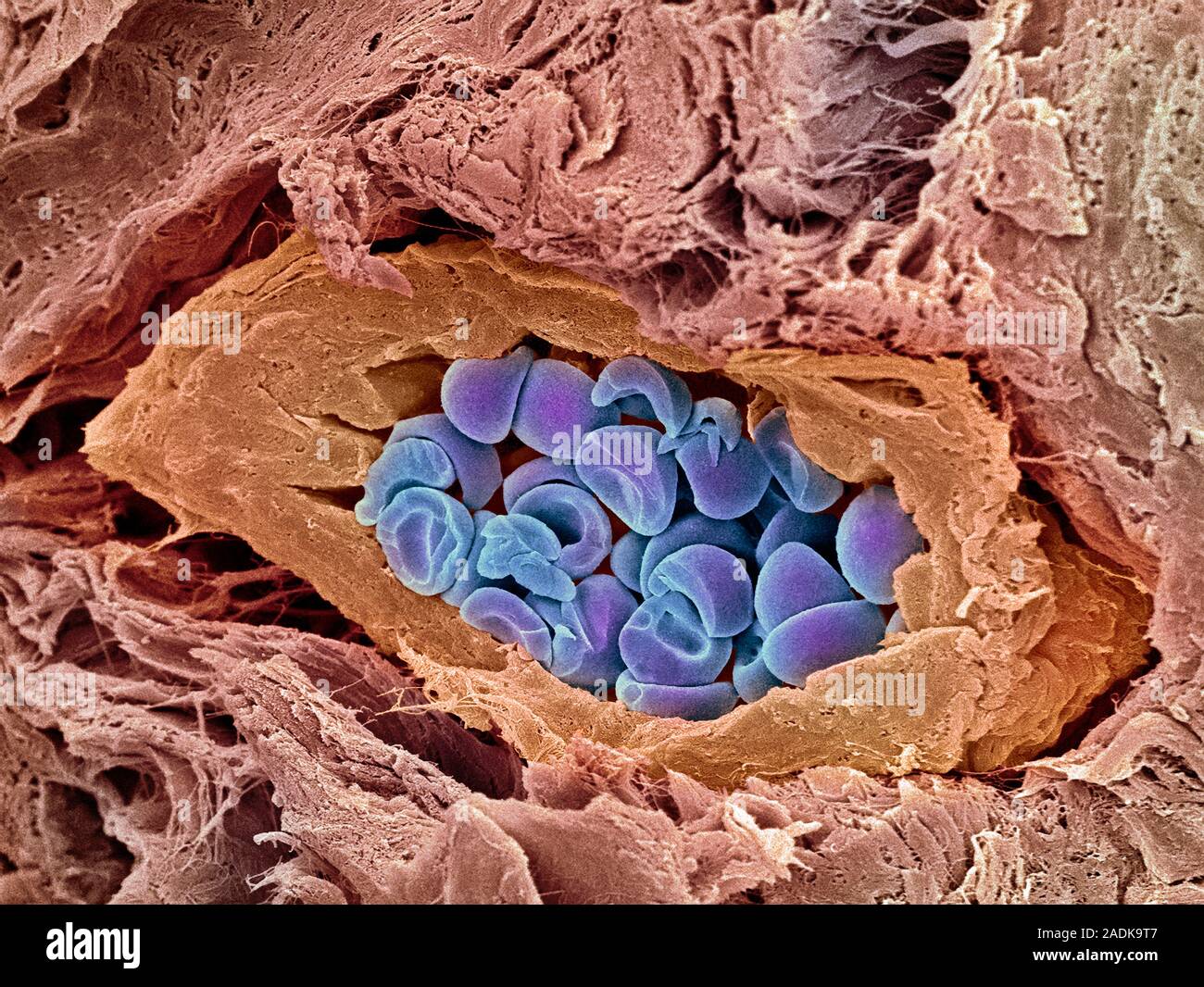 Coronary artery. Coloured scanning electron micrograph (SEM) of an ...