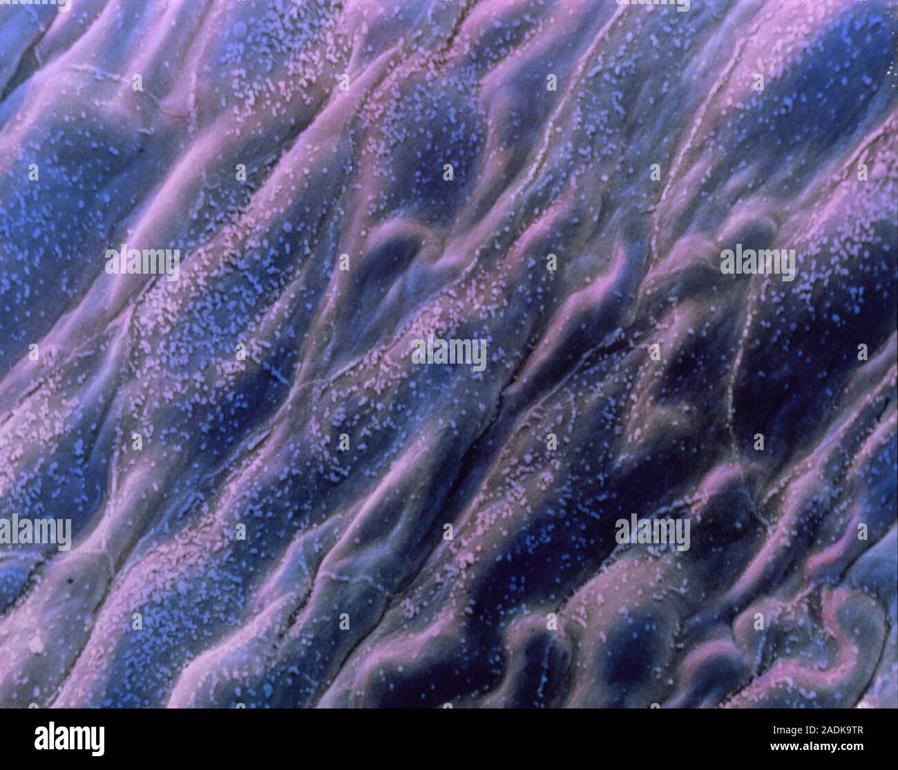 Endothelium. False-colour scanning electron micrograph (SEM) of the ...