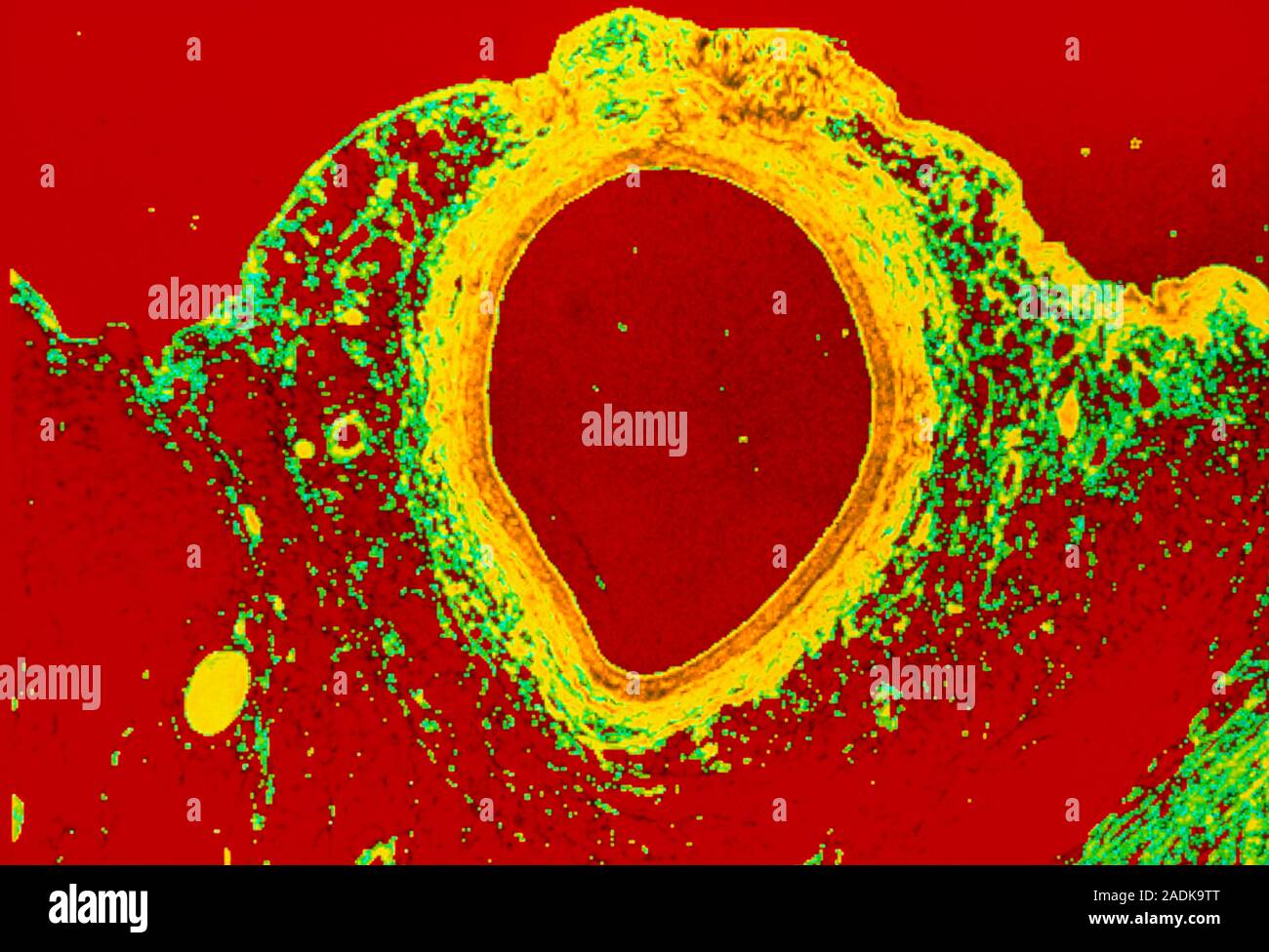 Digitised light micrograph of a cross-section of a healthy human artery ...