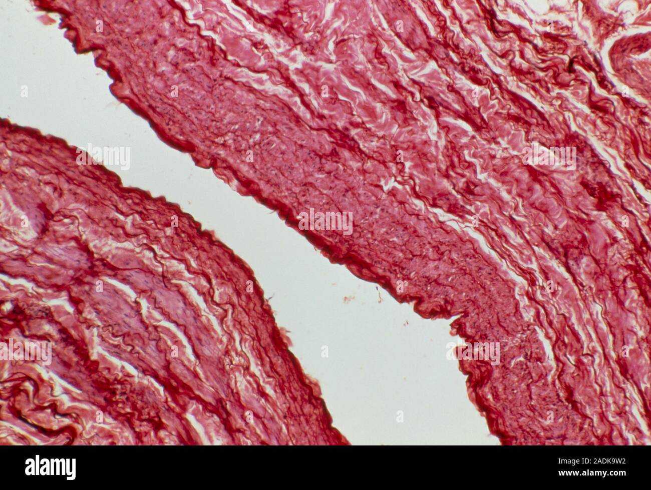 Light micrograph of a longitudinal section of a large vein (lumen white ...