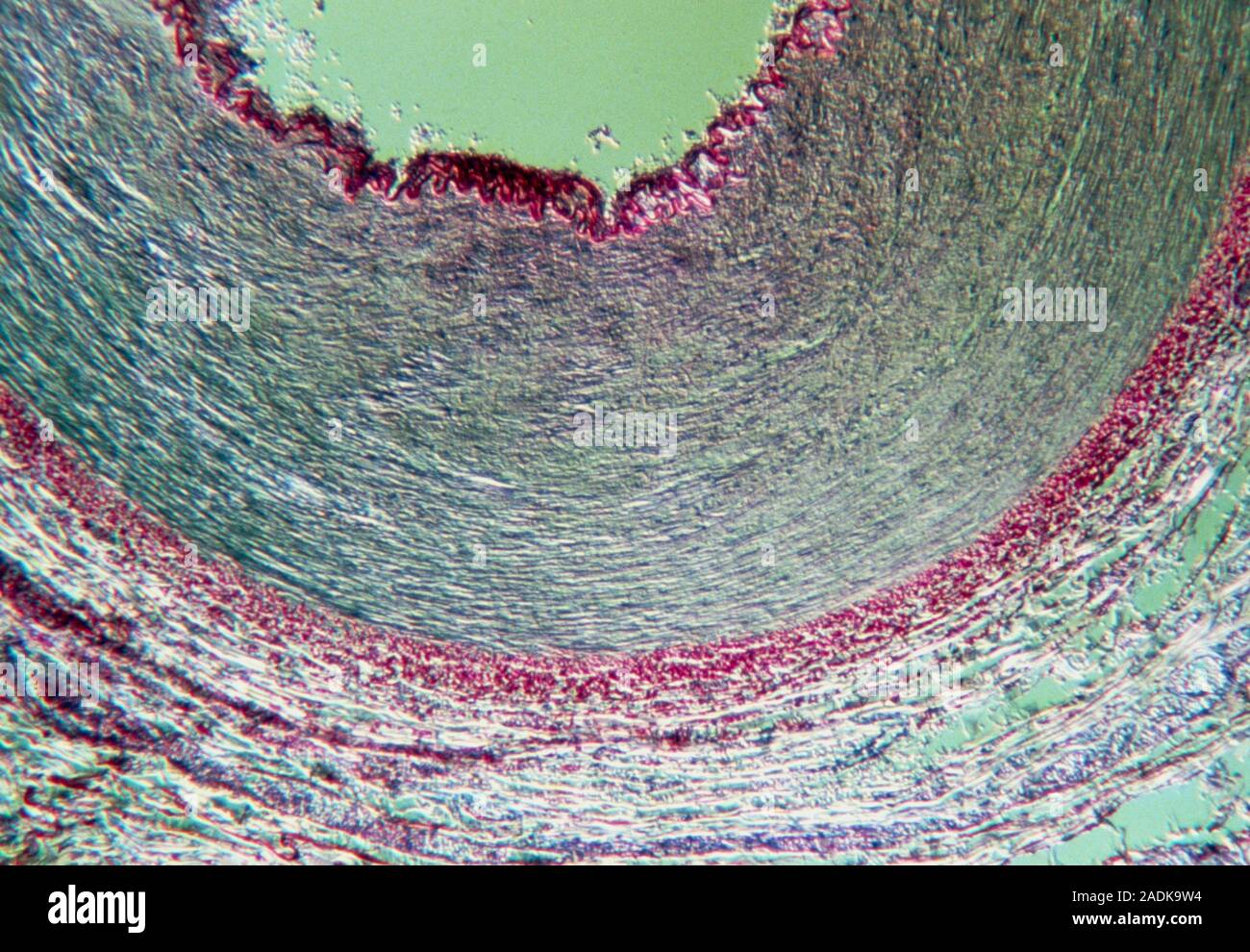 Artery. Light micrograph of a cross-section through a healthy human ...