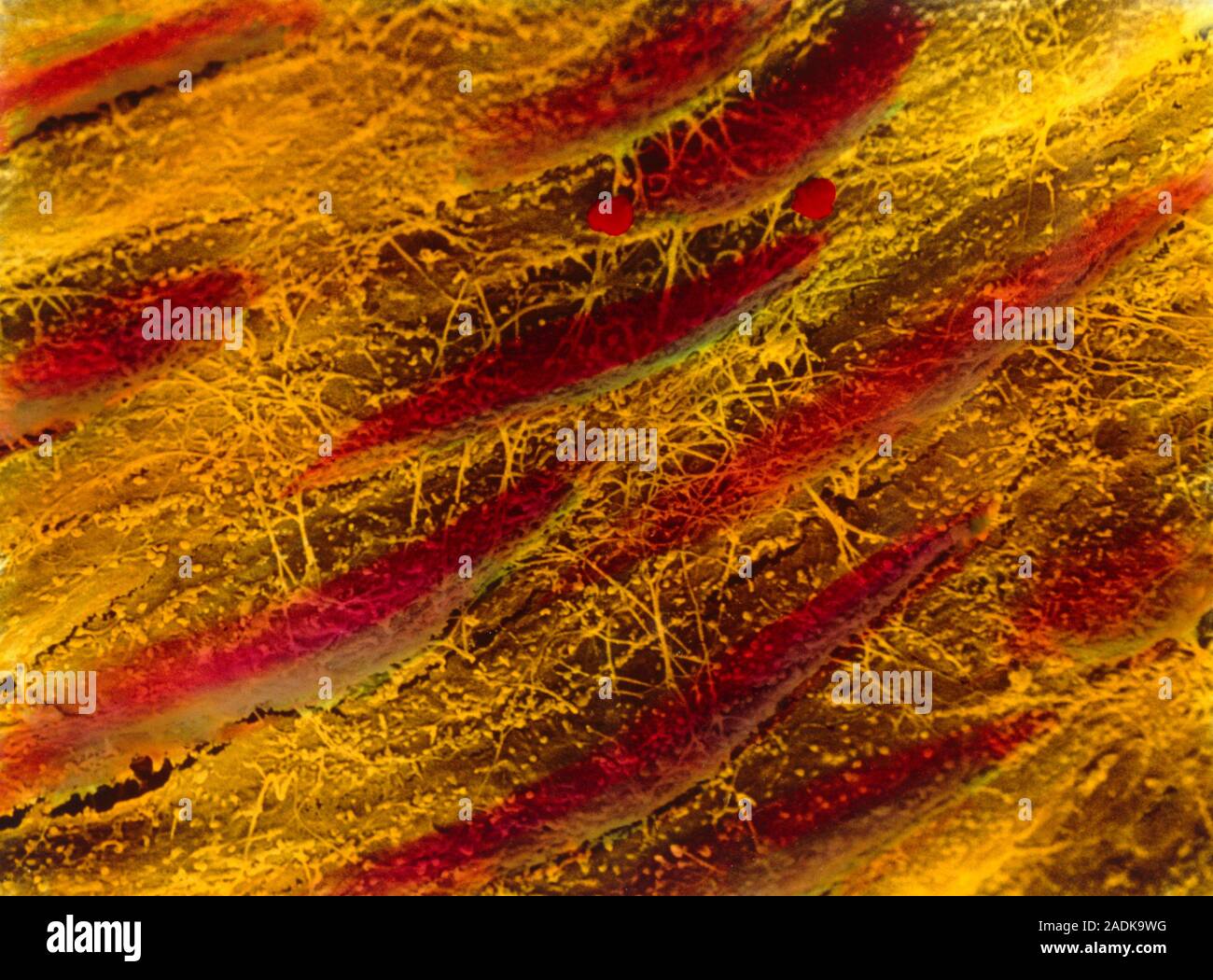 Artery wall. Coloured scanning electron micrograph of the inner wall ...