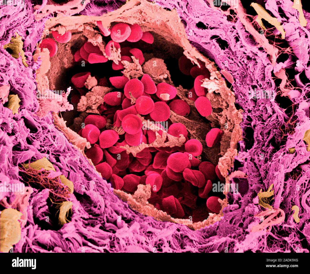 Skin blood vessel. Coloured scanning electron micrograph (SEM) of a ...