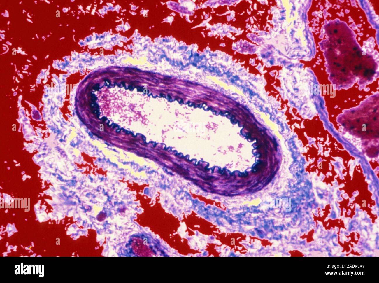 Artery. Light micrograph of a section through a healthy human artery ...