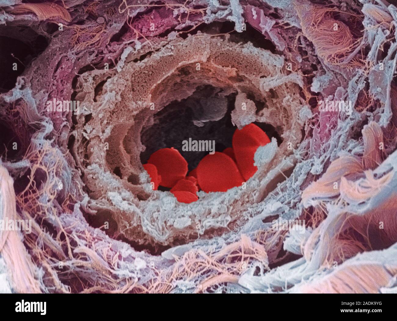 Blood vessel. Coloured scanning electron micrograph (SEM) of a section ...
