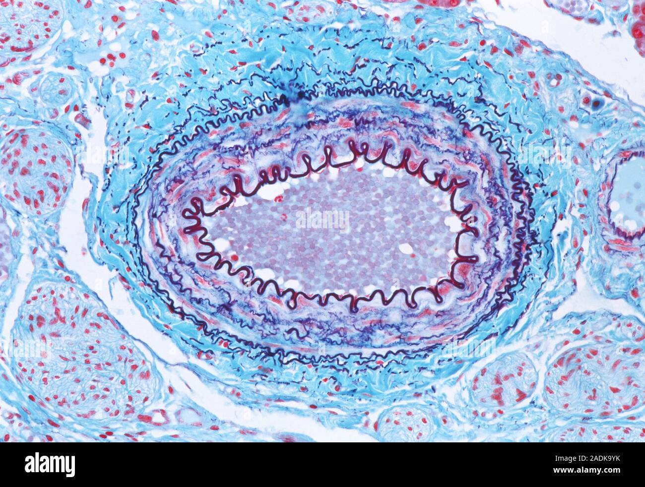 Arteriole. Light micrograph of an arteriole in cross-section ...