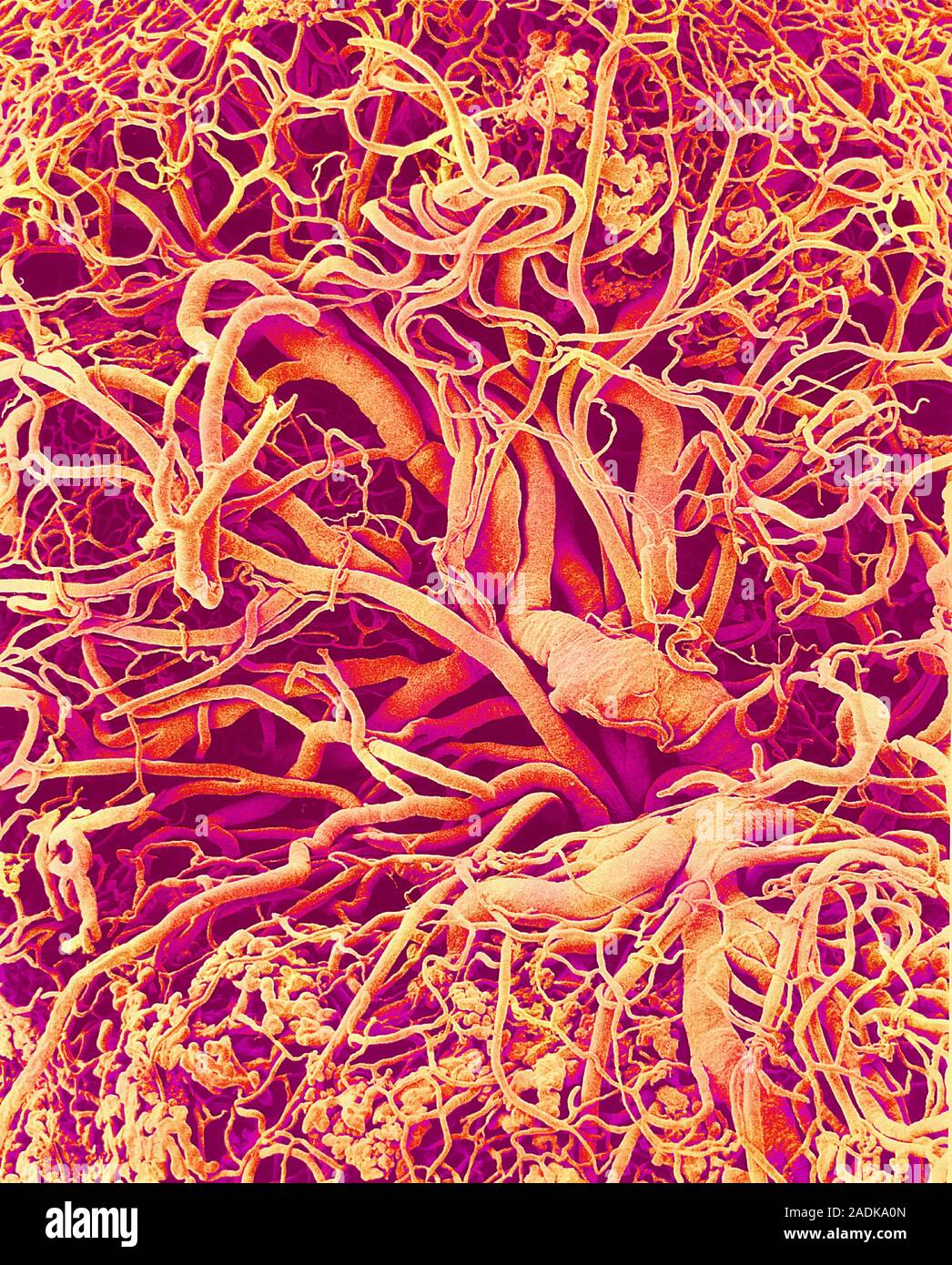 Blood vessels. Coloured scanning electron micrograph (SEM) of a resin ...
