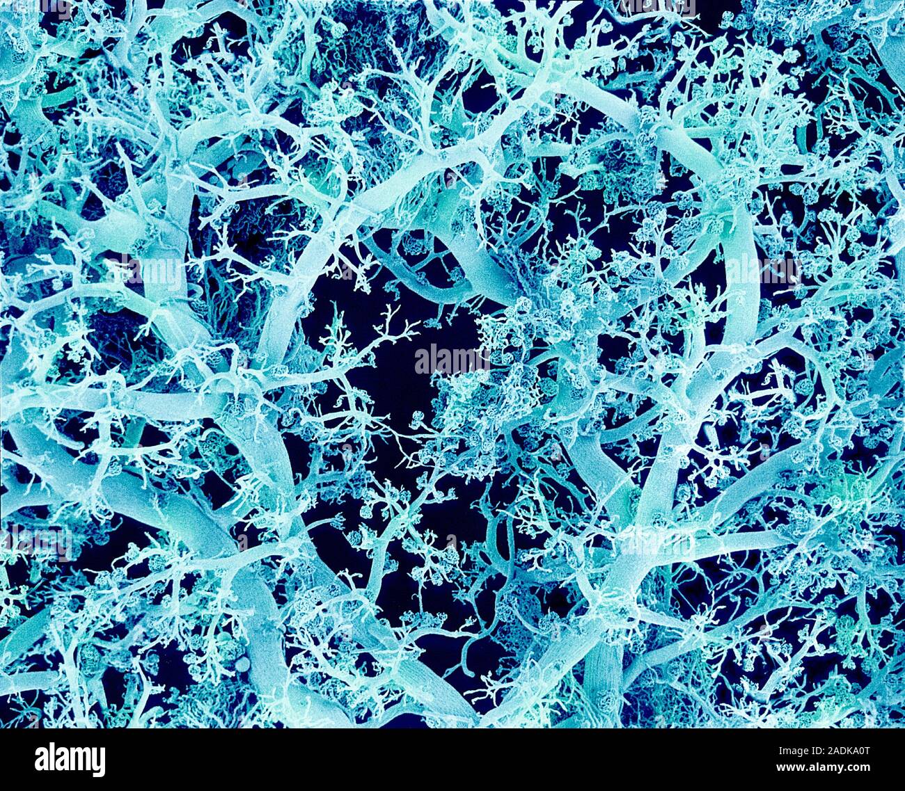 Blood vessels. Coloured scanning electron micrograph (SEM) of a resin ...