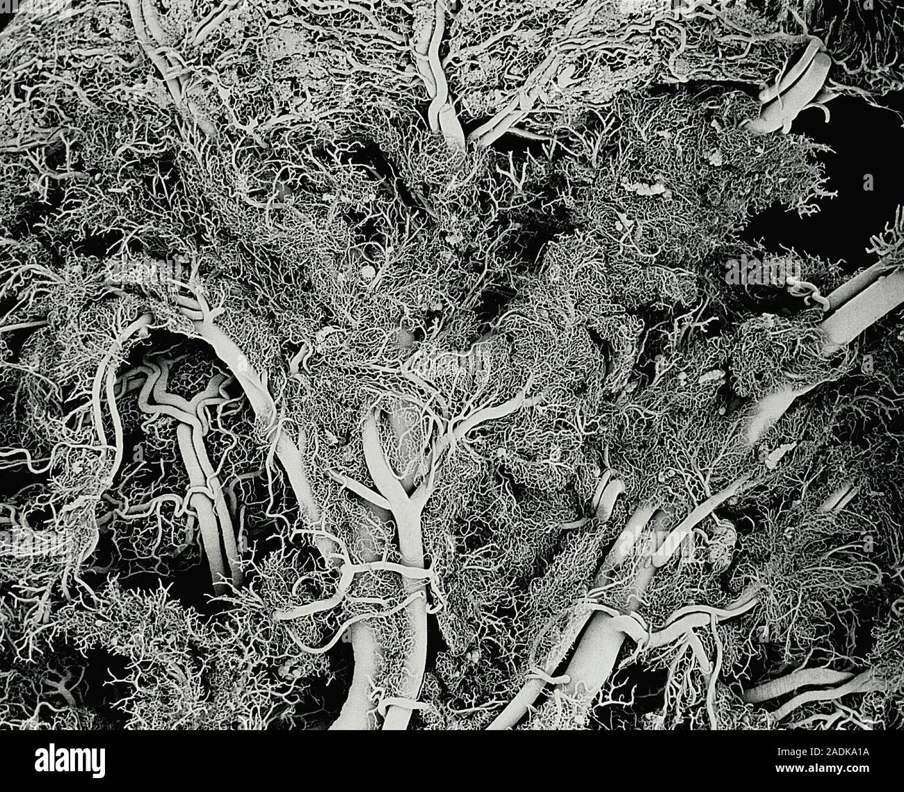 Blood vessels. Scanning electron micrograph (SEM) of a resin cast of ...