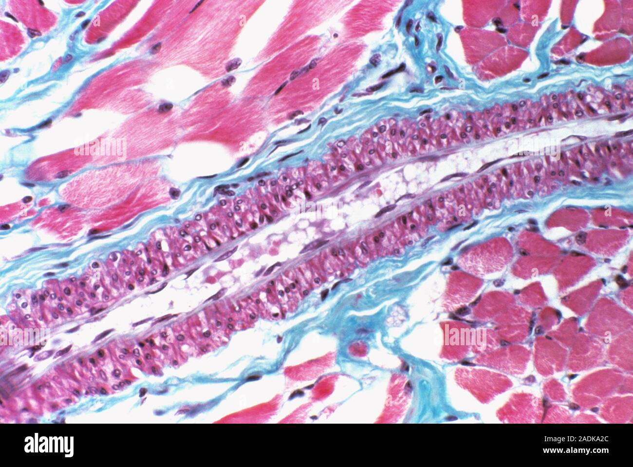 Arteriole. Light micrograph of a longitudinal section through an ...