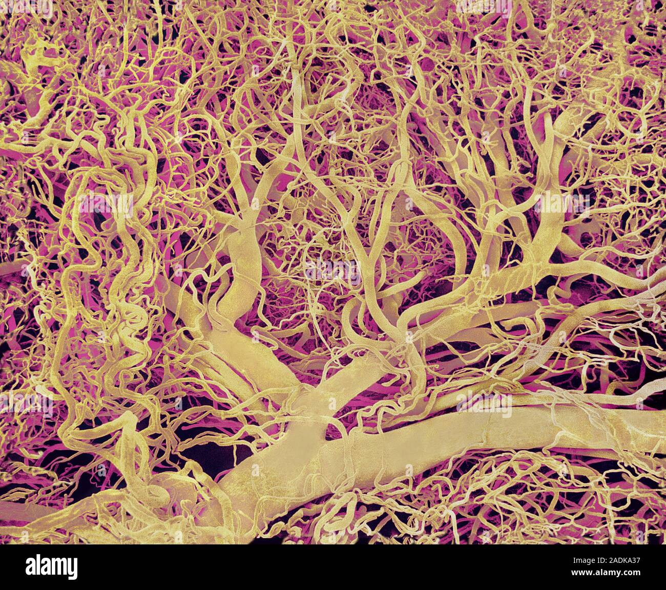 Blood vessels. Coloured scanning electron micrograph (SEM) of a resin ...