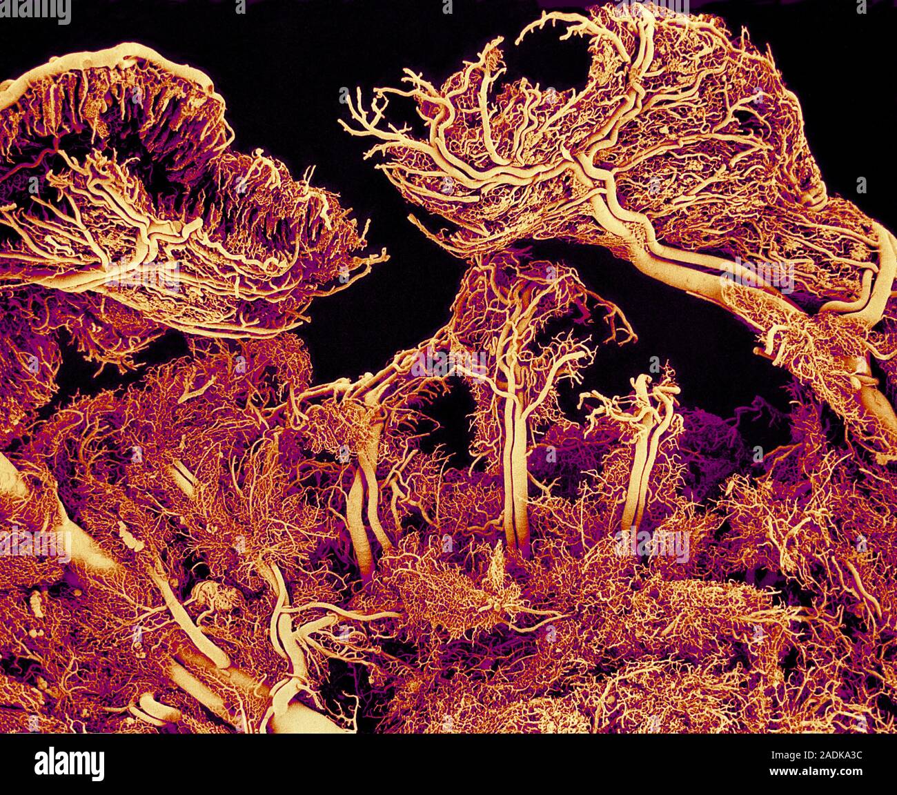 Blood vessels. Coloured scanning electron micrograph (SEM) of a resin ...