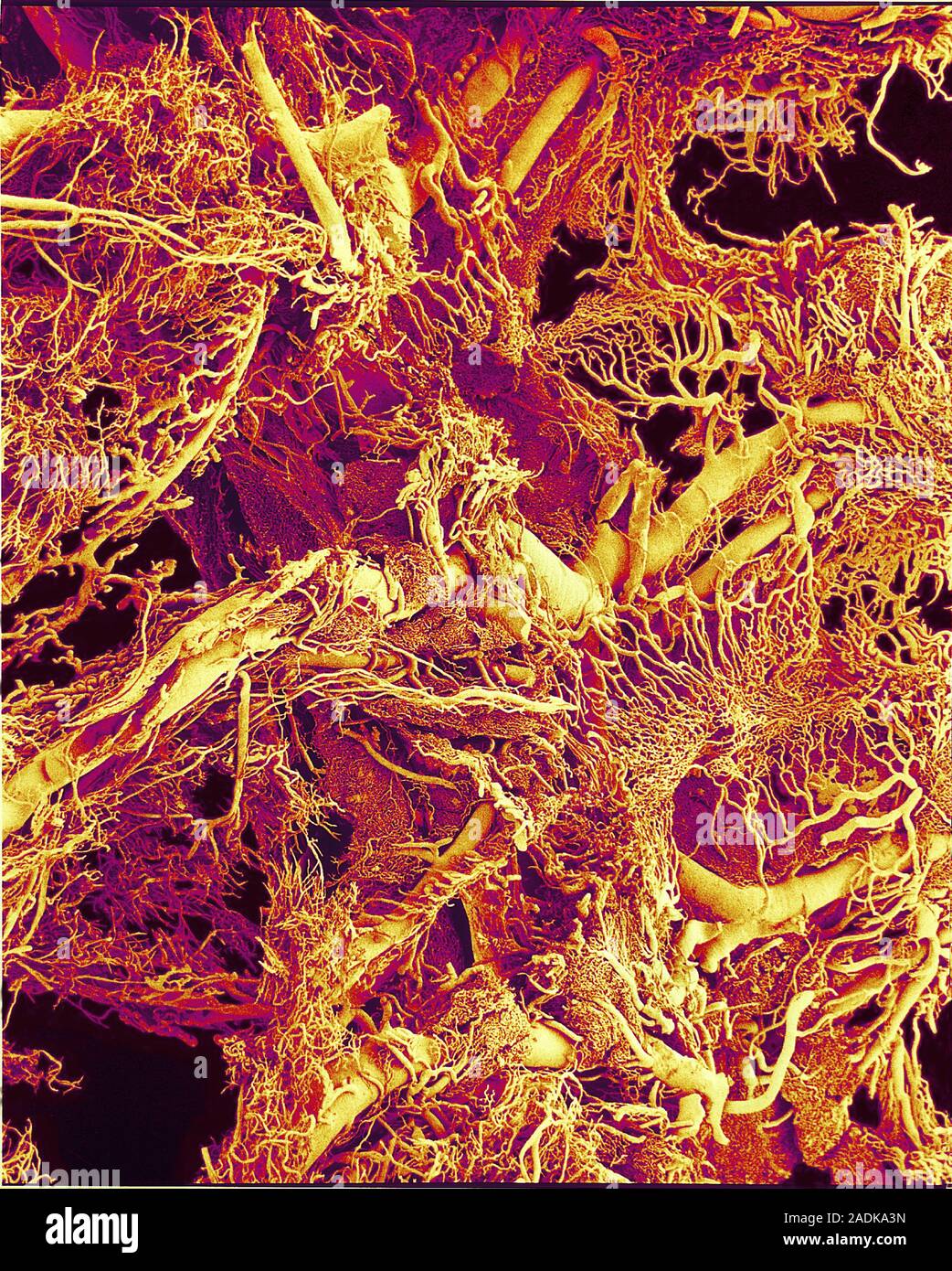 Blood vessels resin cast. Coloured scanning electron micrograph (SEM ...