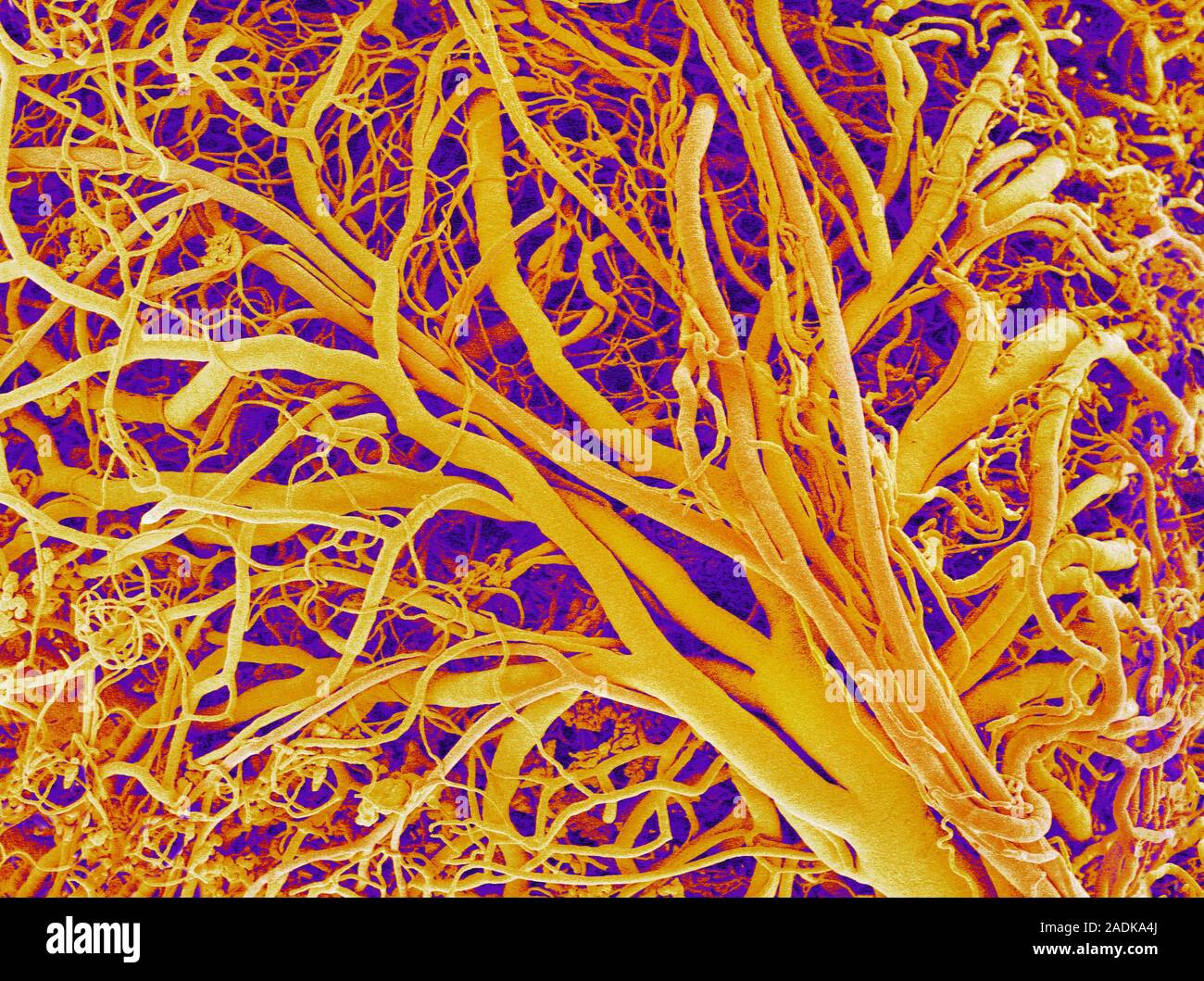 Blood vessels. Coloured scanning electron micrograph (SEM) of a resin ...