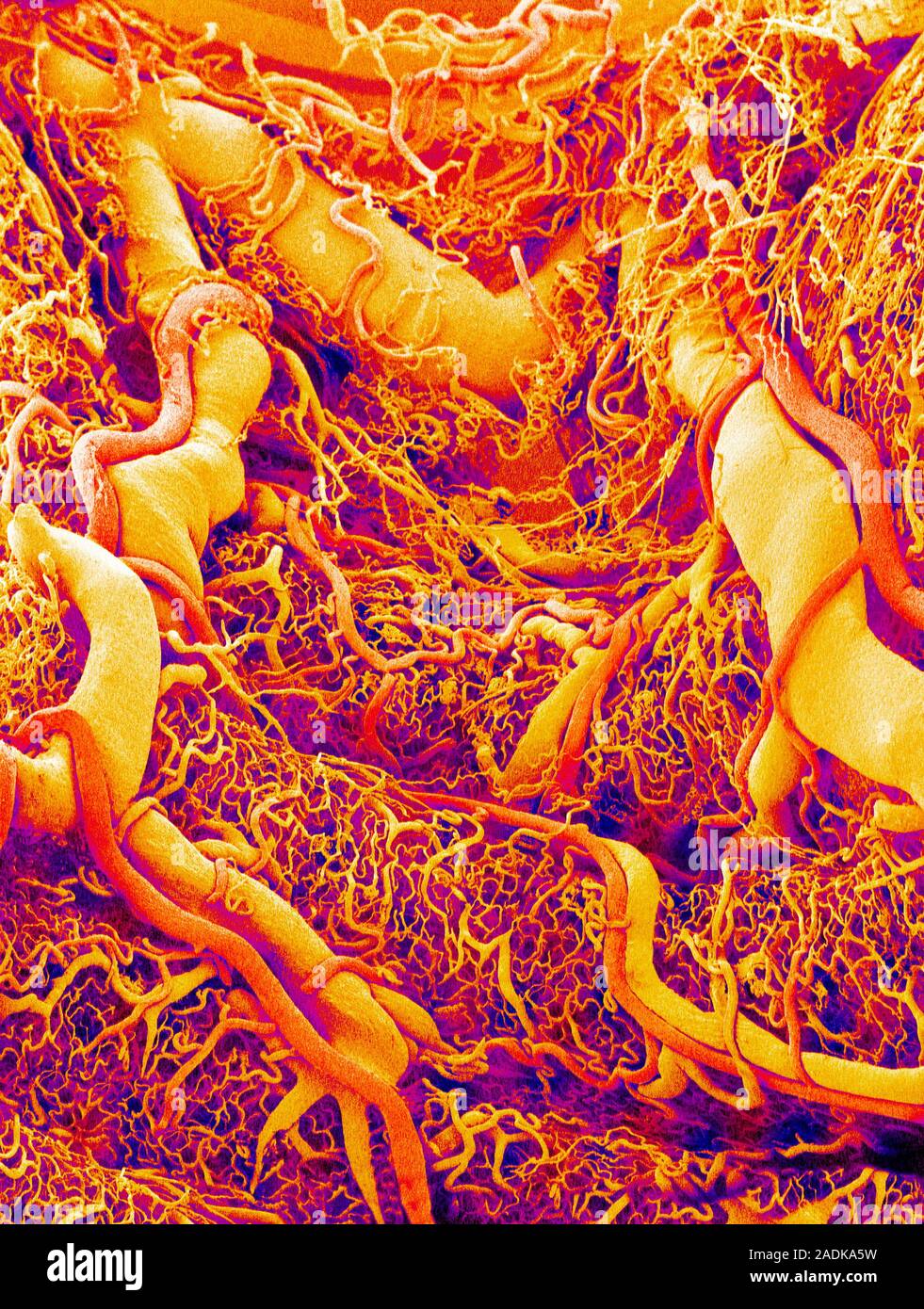 Blood vessels. Coloured scanning electron micrograph (SEM) of a resin ...