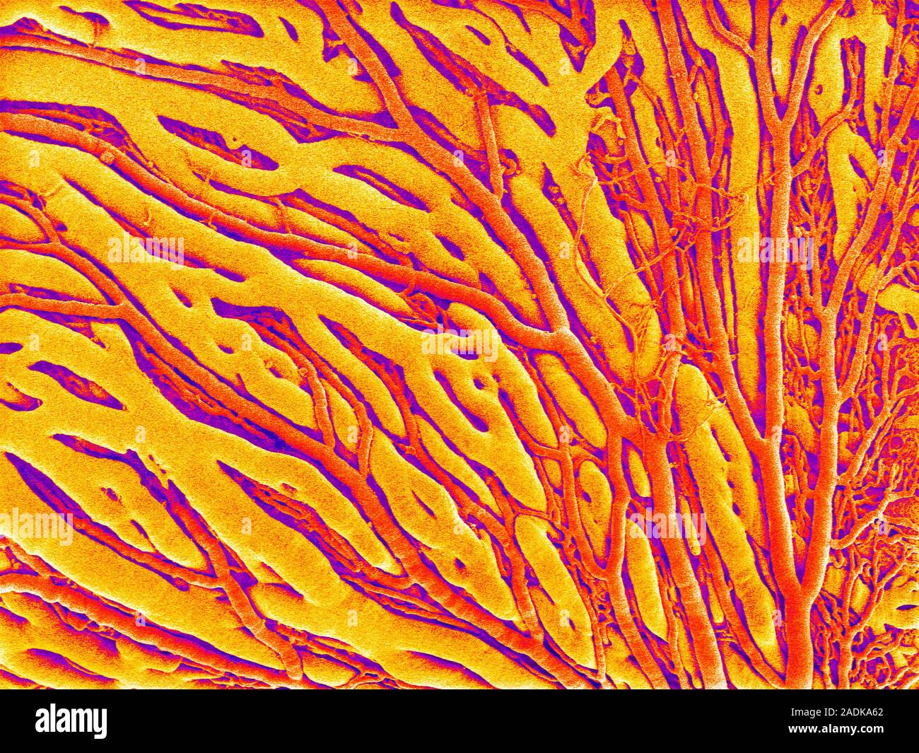 Blood vessels. Coloured scanning electron micrograph (SEM) of blood ...