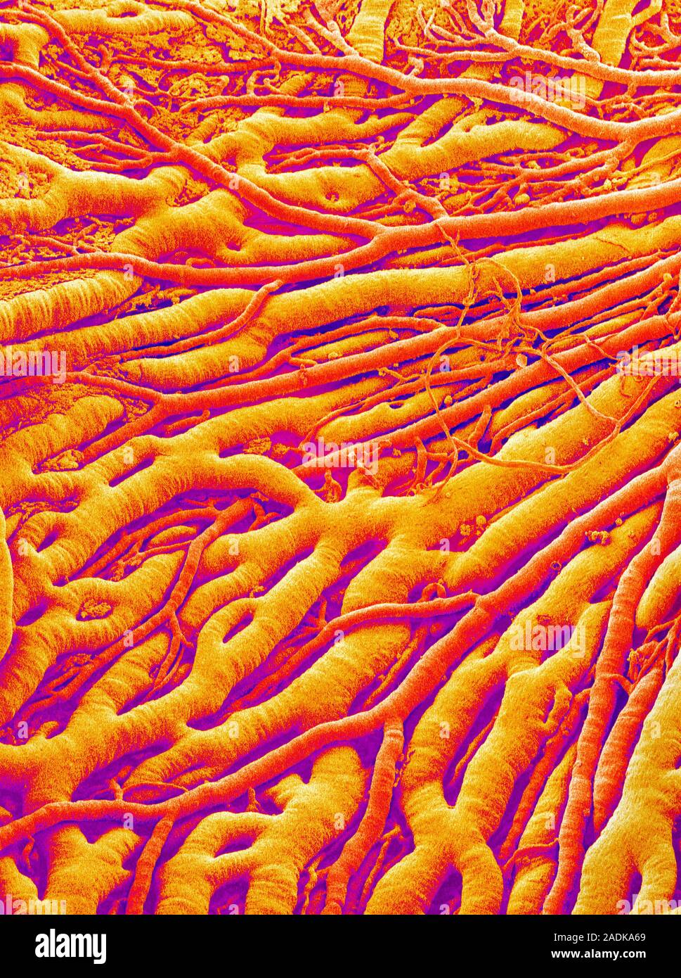 Blood vessels. Coloured scanning electron micrograph (SEM) of blood ...