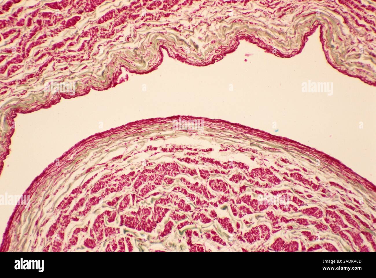 Vena cava. Light micrograph of a transverse section through the vena ...