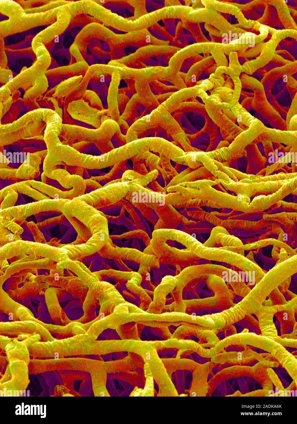 Blood vessels from the colon (large intestine), coloured scanning ...